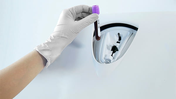 Imunochemický analyzátor Radiometer AQT90 FLEX